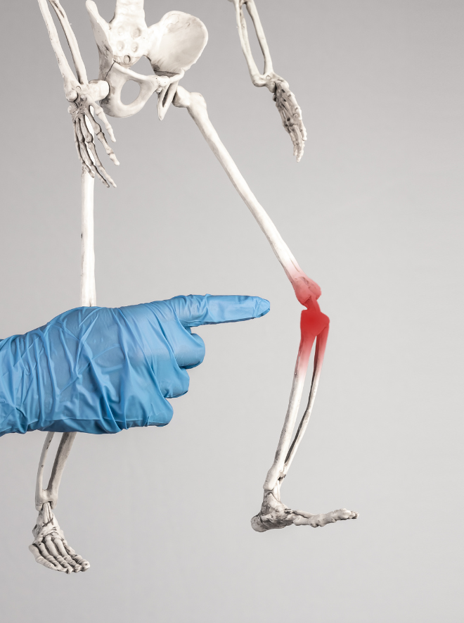 Reumatólogo de urgencia | Dr. Alberto Mariano Saucedo Sánchez ...